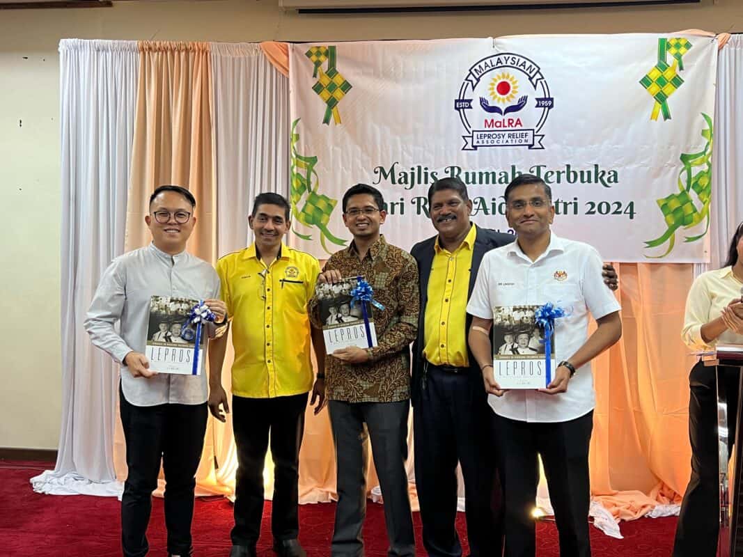 Senator Dr Lingeshwaran urges vigilance against leprosy complications ...